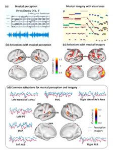 Neuroimaging – Laboratory of Integrated Brain Imaging