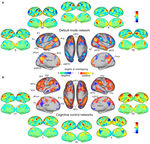 Neuroimaging – Laboratory of Integrated Brain Imaging