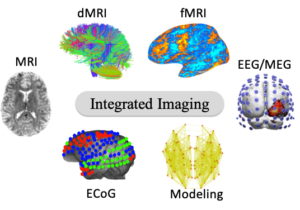 Research – Laboratory of Integrated Brain Imaging